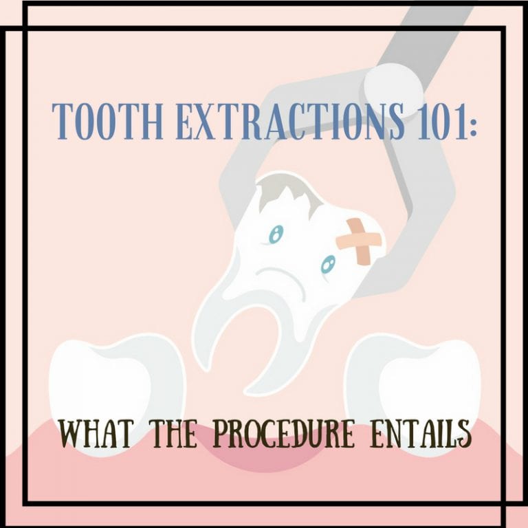 Tooth Extractions 101: What the Procedure Entails | Georgian Shores ...